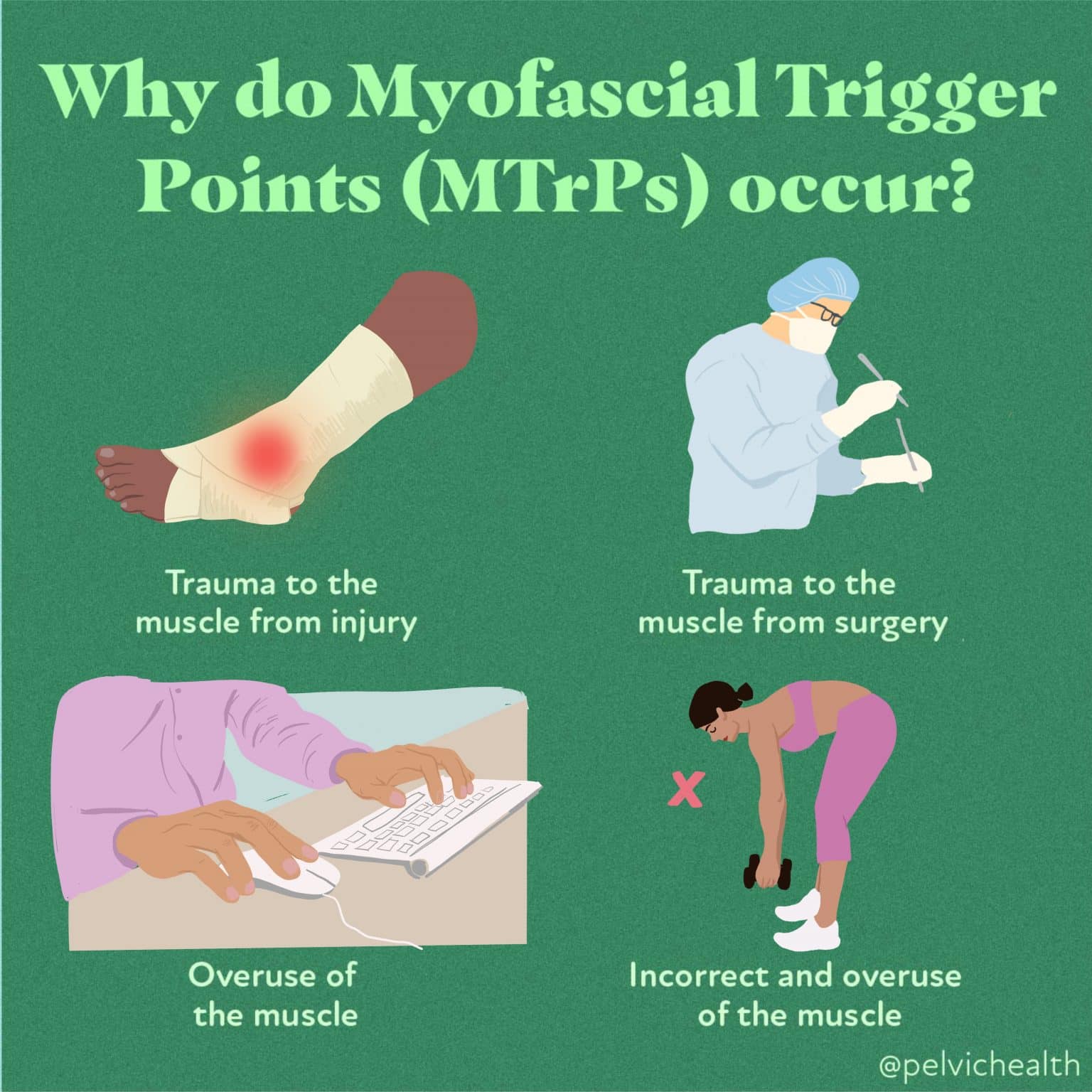 Myofascial Trigger Points: Facts & General Information