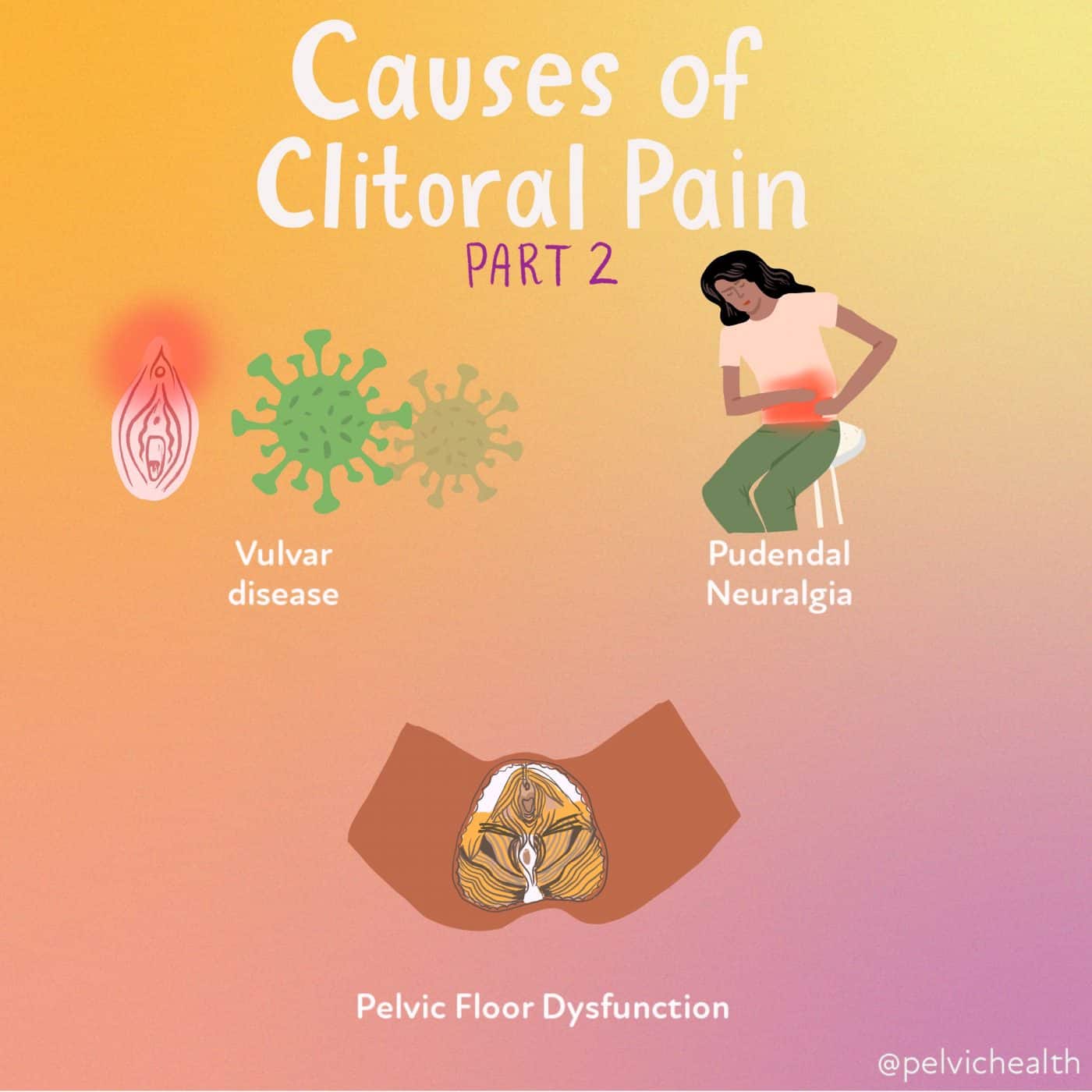 Understanding Clitoral Pain: Causes and Treatments | PHRC