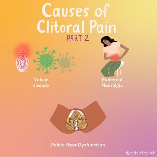 Understanding Clitoral Pain Causes And Treatments Phrc