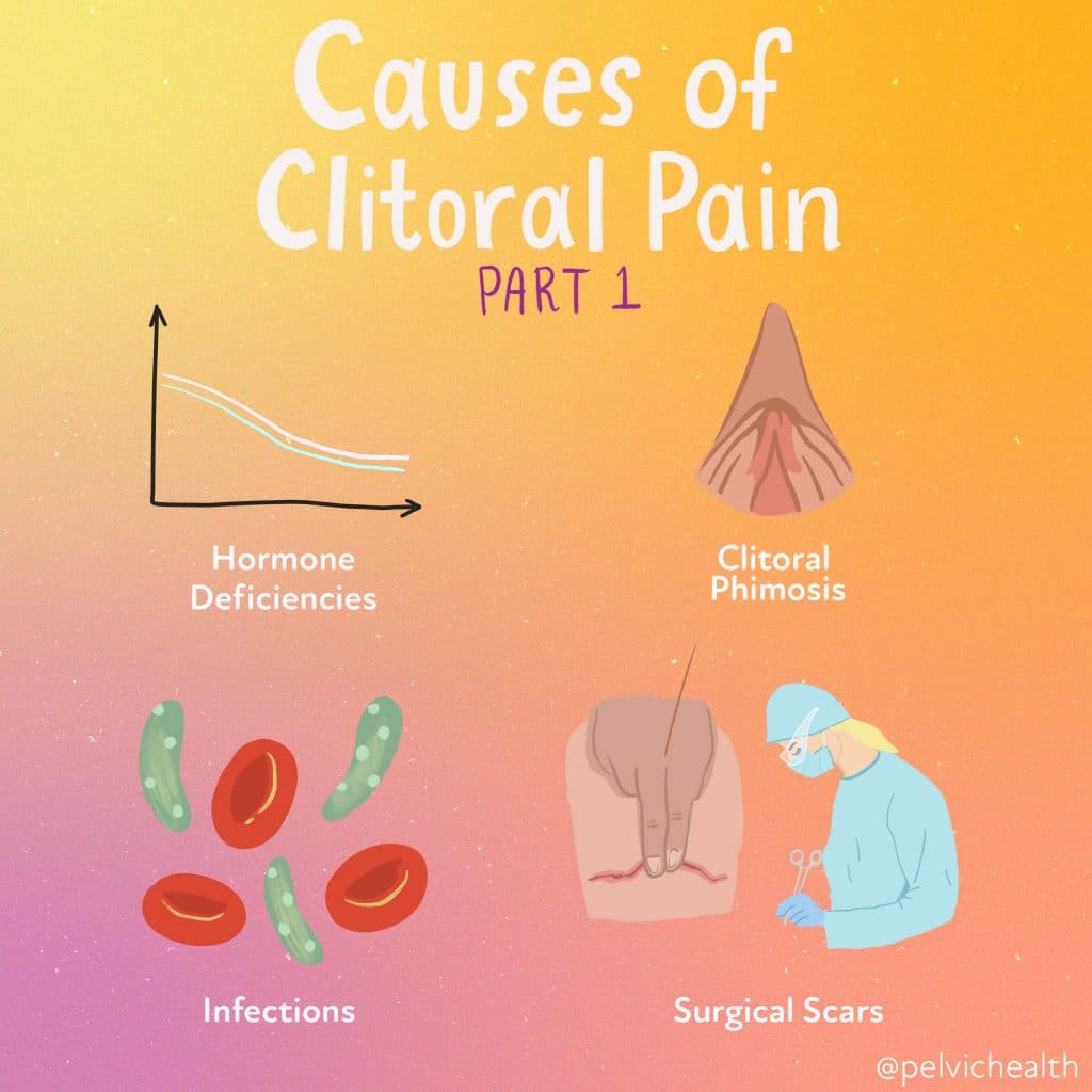 Understanding Clitoral Pain: Causes and Treatments | PHRC