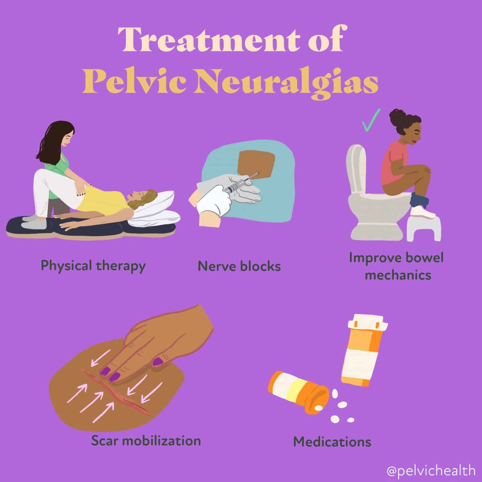 Pelvic Neuralgias: General Info, Causes, and Treatment