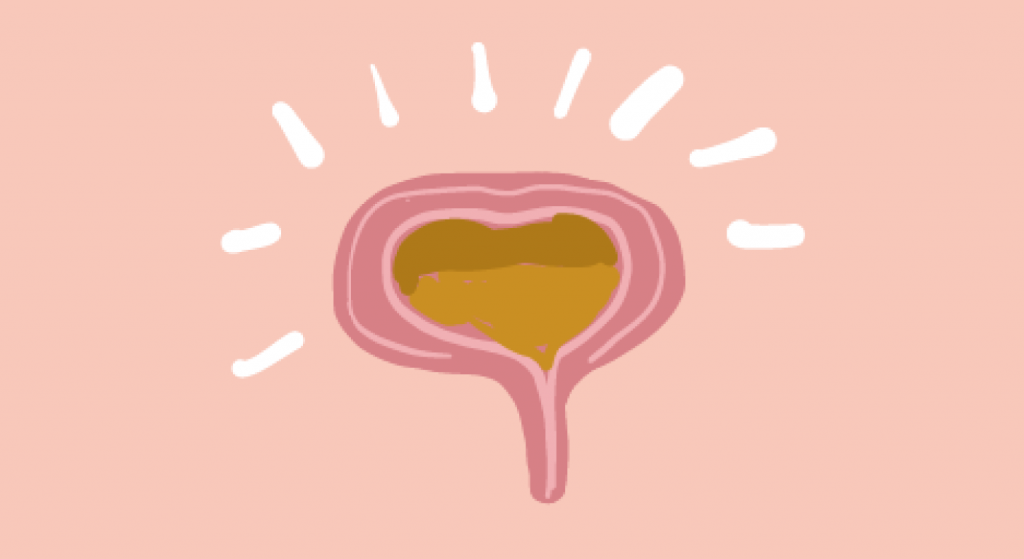 Interstitial Cystitis Pelvic Floor Physical and Occupational Therapy