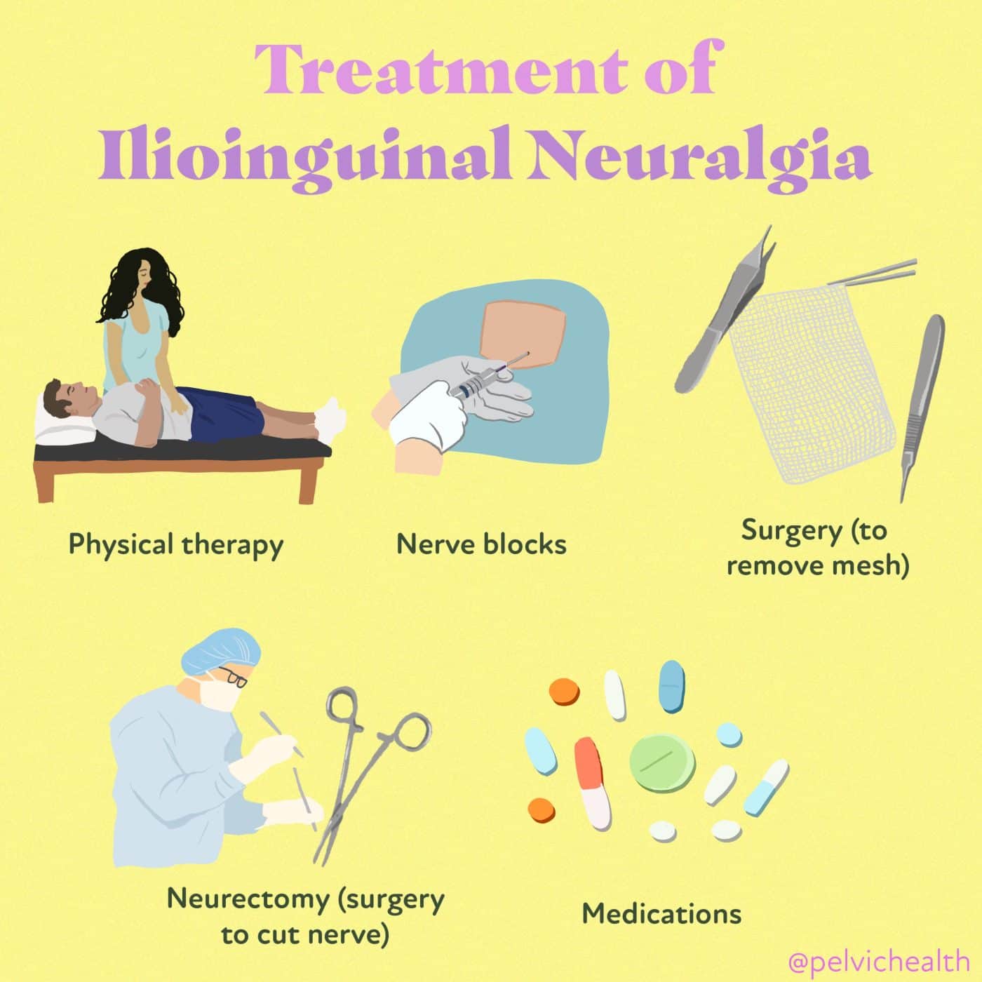 Ilioinguinal Neuralgia: Causes and Treatment