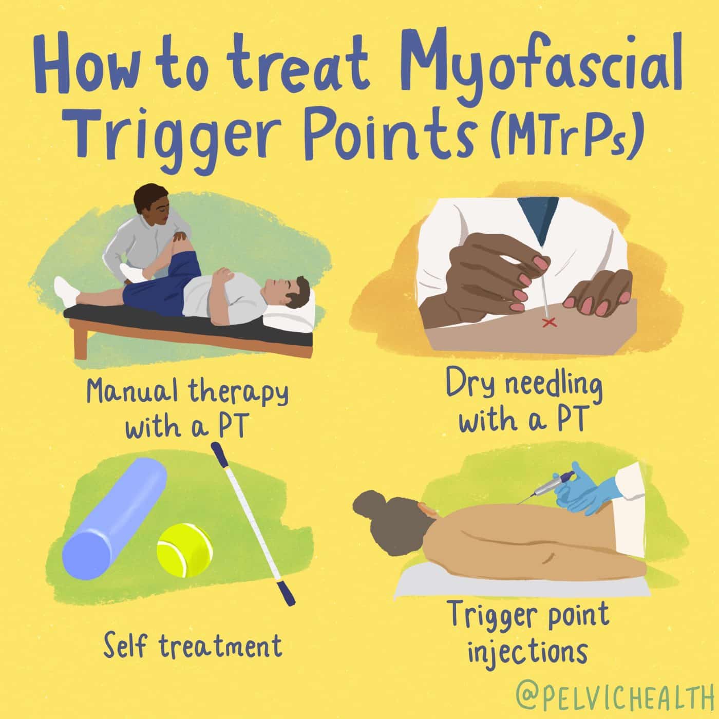 Myofascial Trigger Point: What They Cause + Treatments
