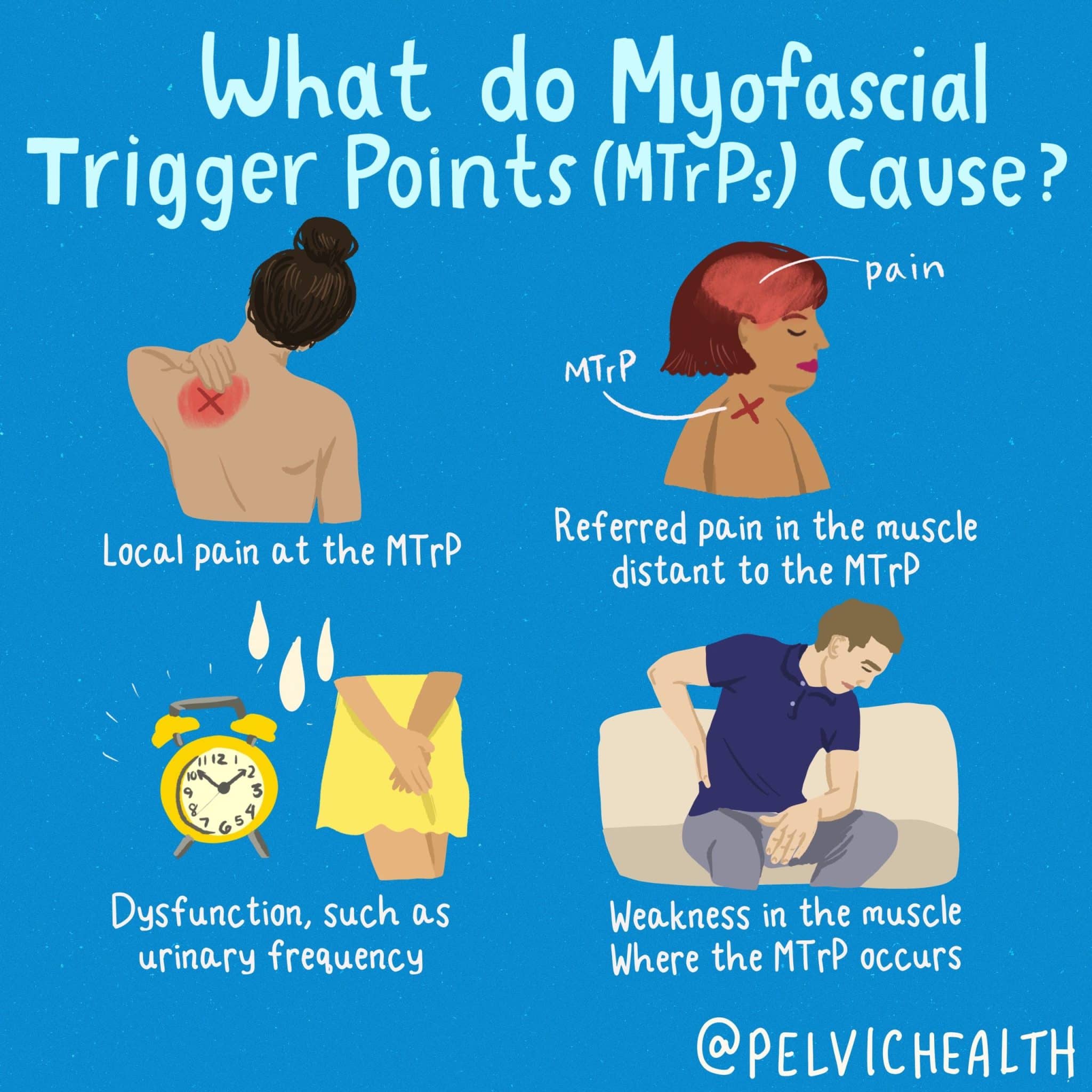 Myofascial Trigger Point What They Cause Treatments