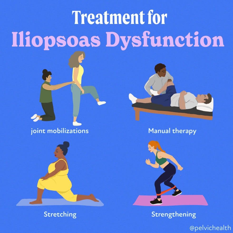 Iliopsoas Dysfunction: Anatomy, Symptoms and Treatments
