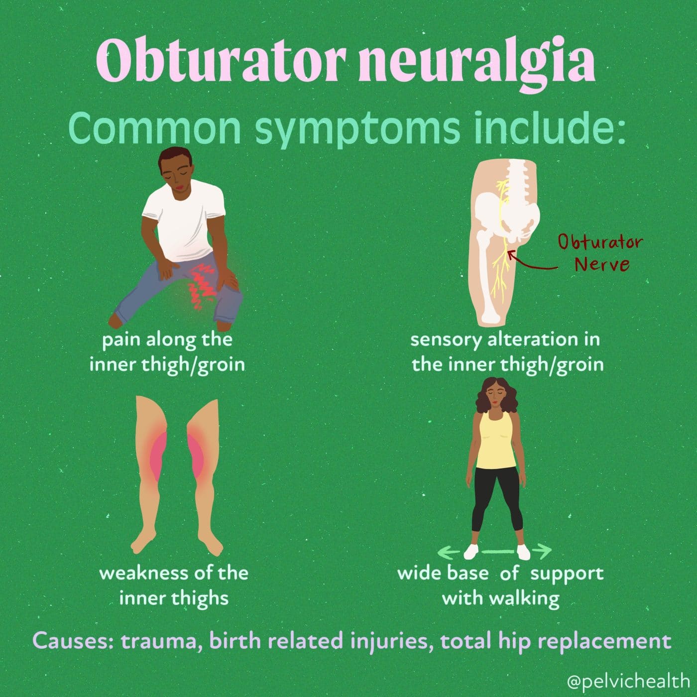 Obturator Internus: Anatomy, Dysfunction and Symptoms
