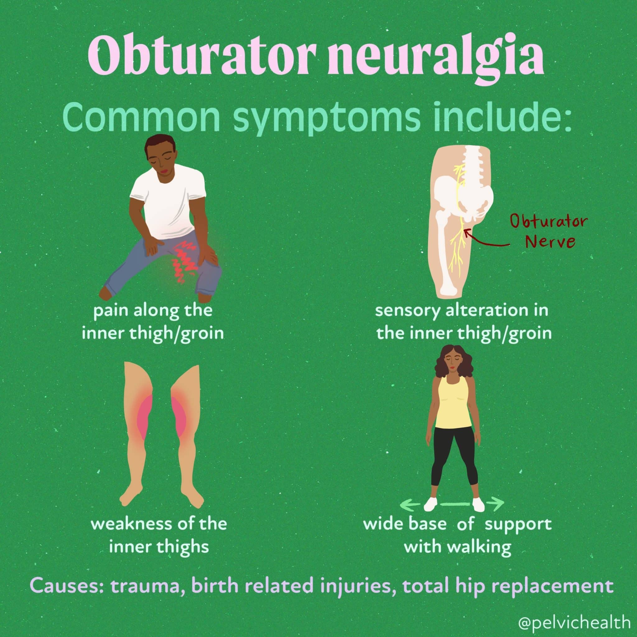 Obturator Internus: Anatomy, Dysfunction and Symptoms
