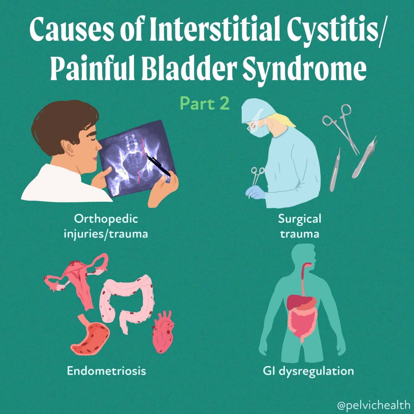 Causes of Interstitial Cystitis/Painful Bladder Syndrome