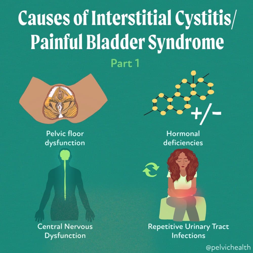 Causes of Interstitial Cystitis/Painful Bladder Syndrome