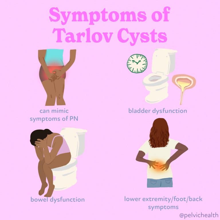 Tarlov Cysts Demystified: What You Need to Know | PHRC