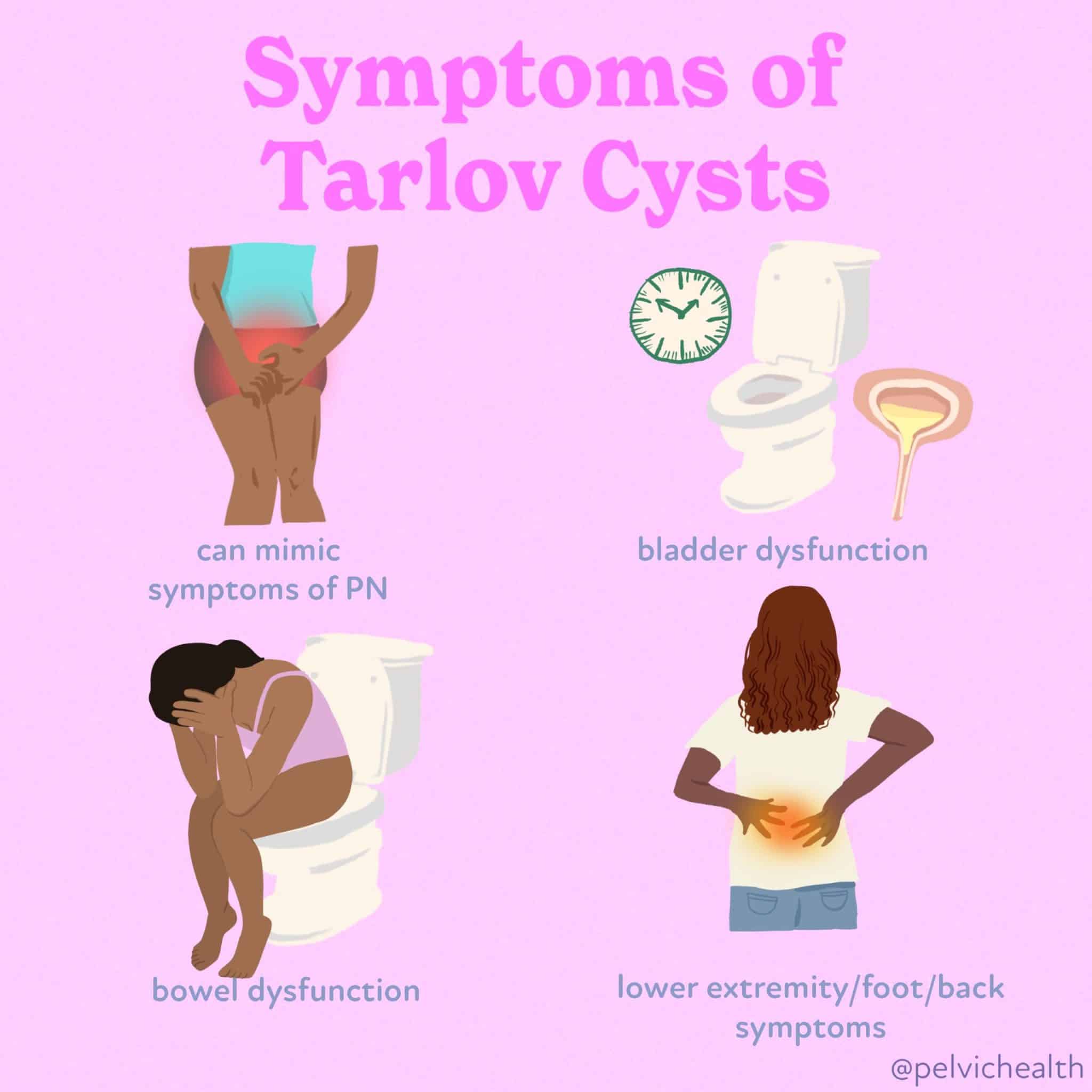 Tarlov Cysts Demystified: What You Need to Know | PHRC