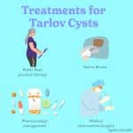 Tarlov Cysts Demystified: What You Need to Know | PHRC
