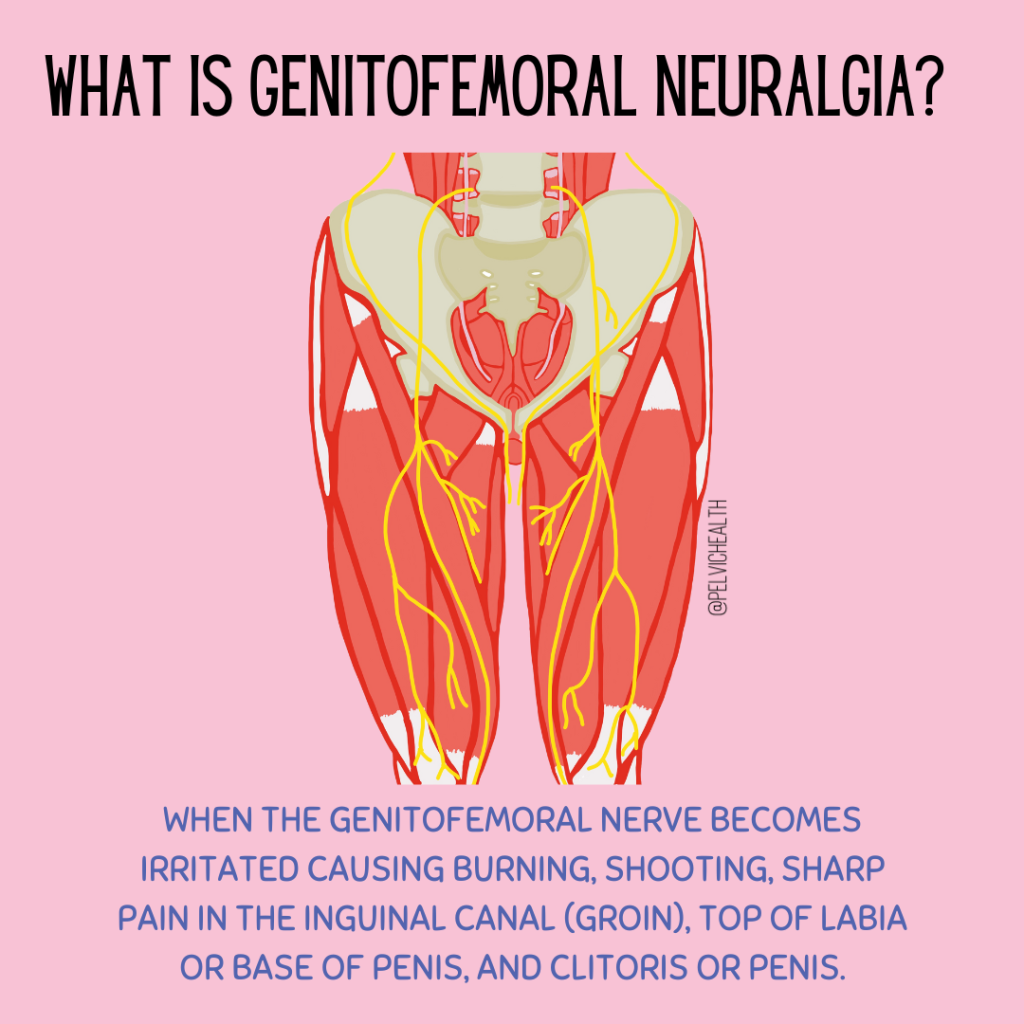 Neuropathic Pain in Pelvis: Q&A