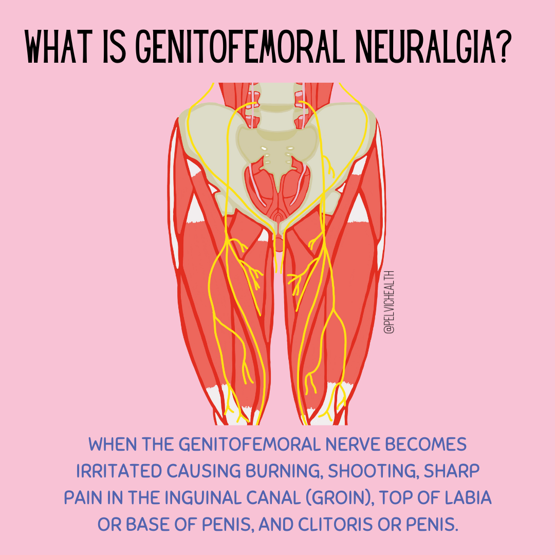 Neuropathic Pain in Pelvis: Q&A
