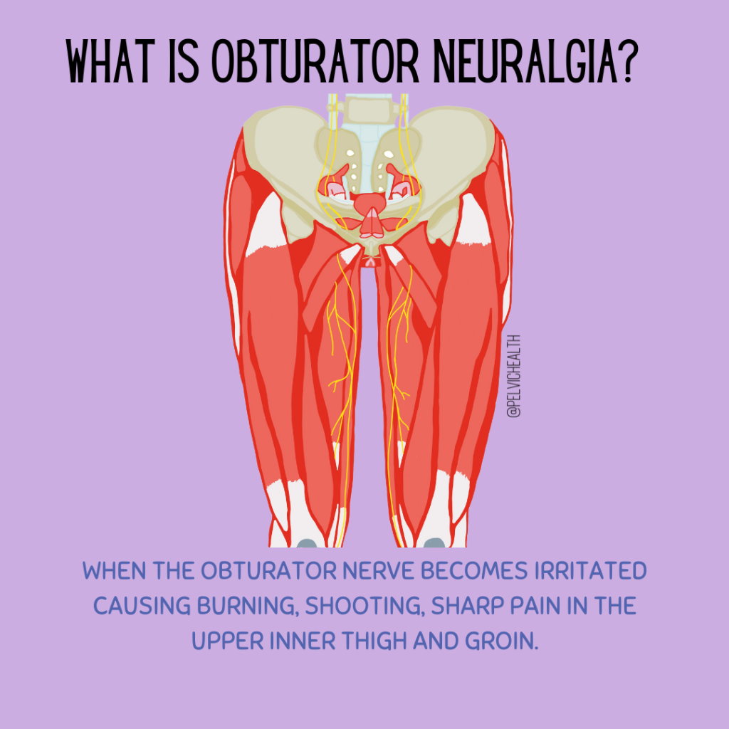 Neuropathic Pain in Pelvis: Q&A