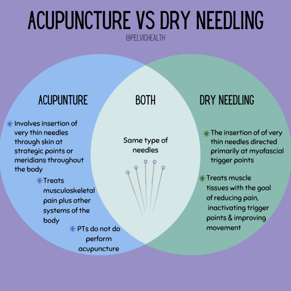 Dry Needling- How It’s Relevant To Pelvic Health