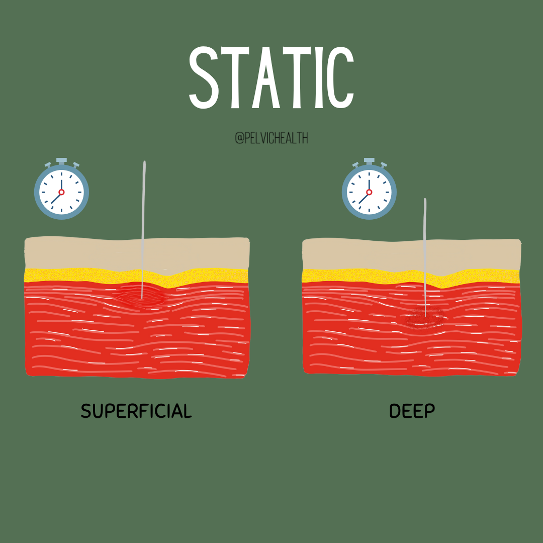 Dry Needling- How It’s Relevant To Pelvic Health