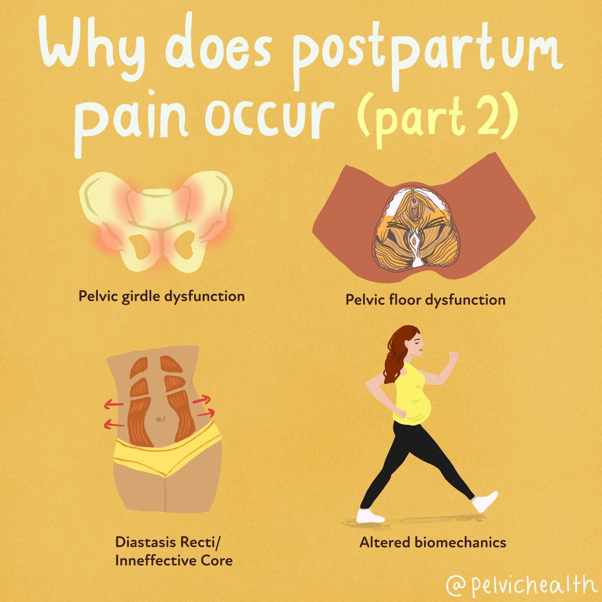 Recovering Postpartum: Pain and Perineal Tears