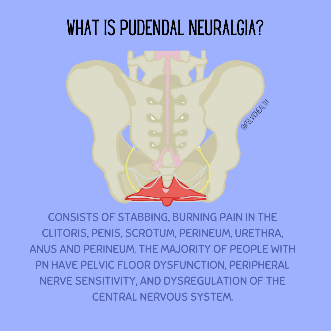 Differential Diagnosis of Cauda Equina VS Pudendal Neuralgia