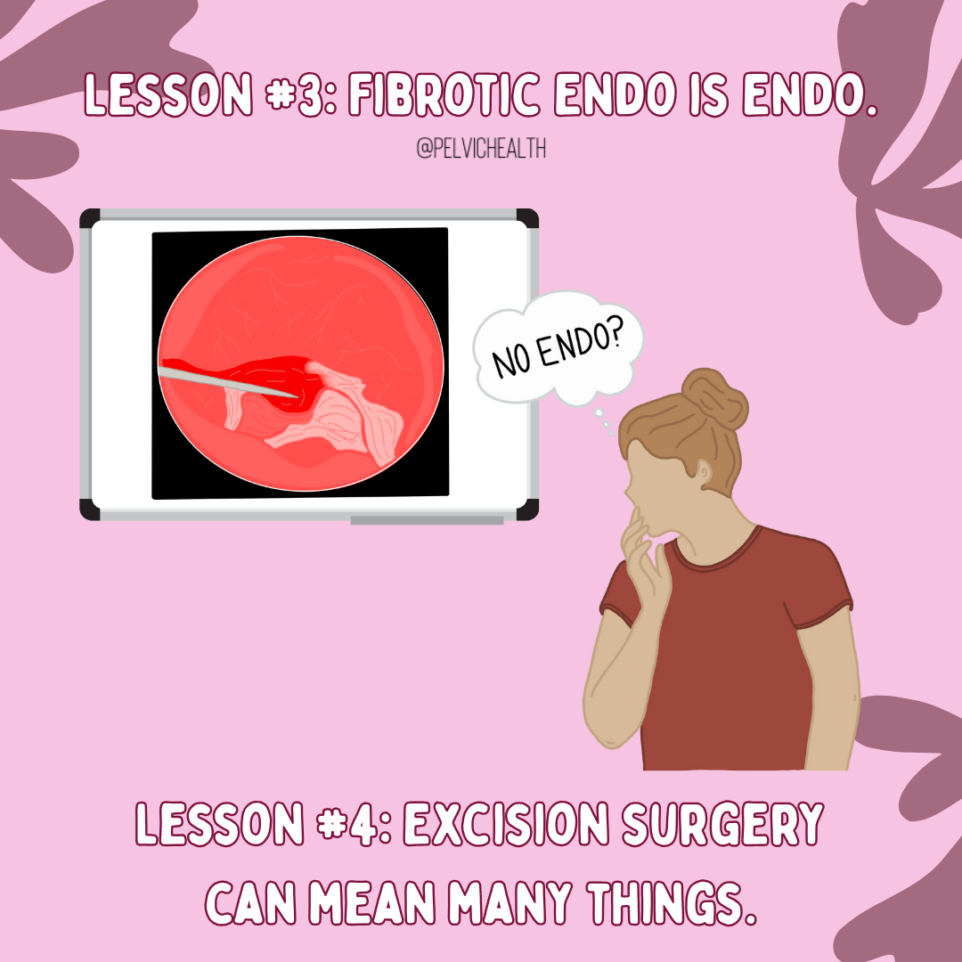 Endometriosis Awareness Month: Lessons Learned