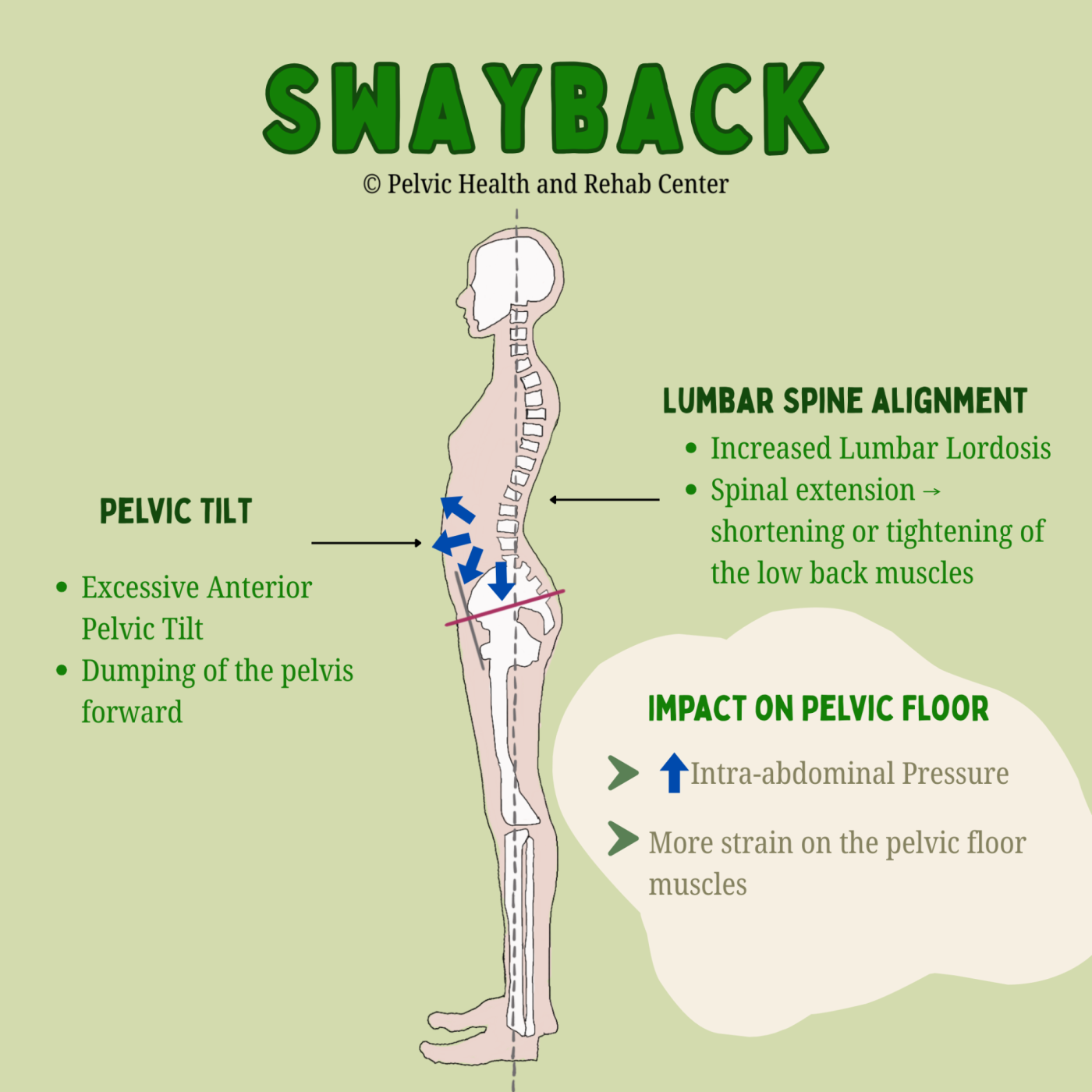Posture and the Pelvic Floor: Why Your Posture Matters!