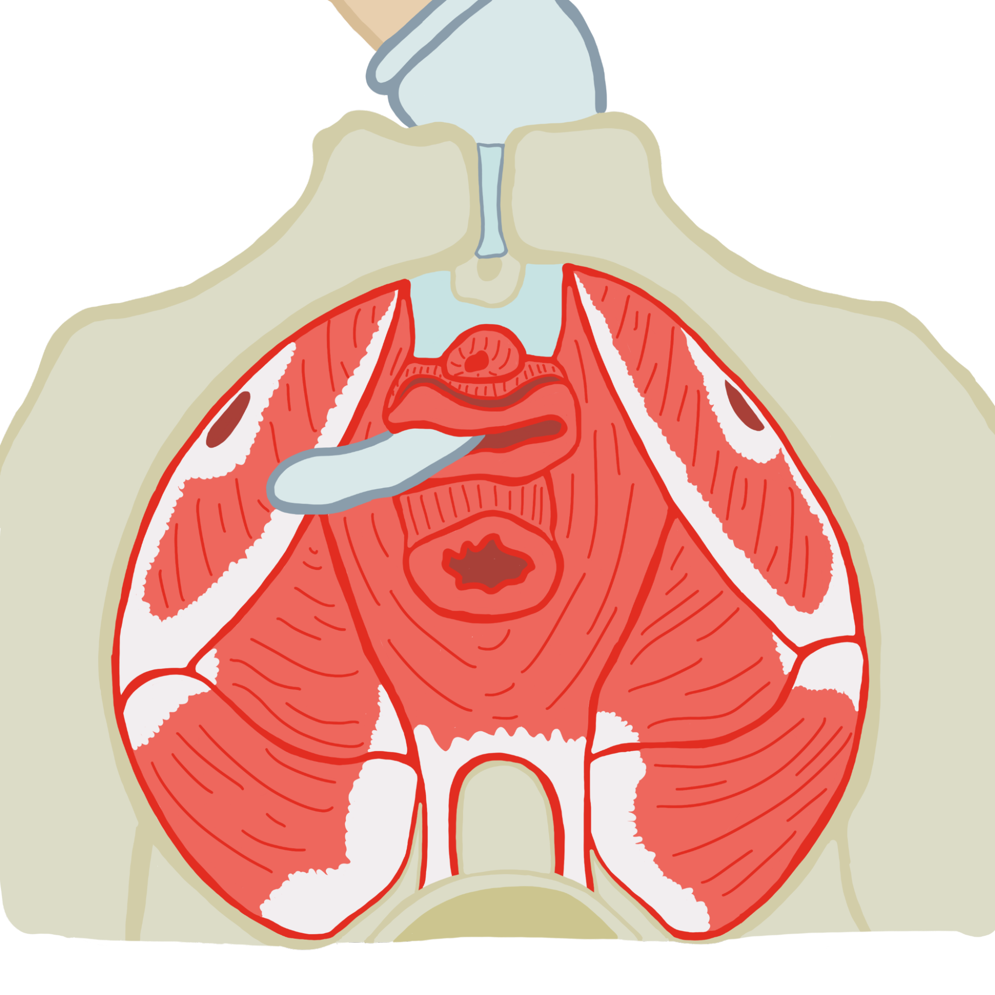 Obturator Internus: A Treatable But Often Overlooked Little Beast