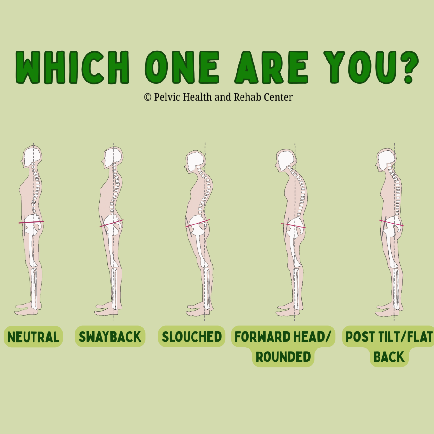 Posture and the Pelvic Floor: Why Your Posture Matters!