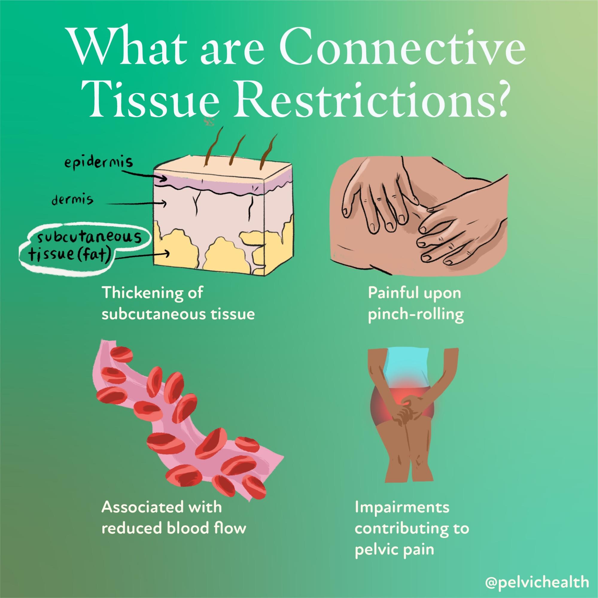 Manual Therapy for Myofascial Pain: Part 1